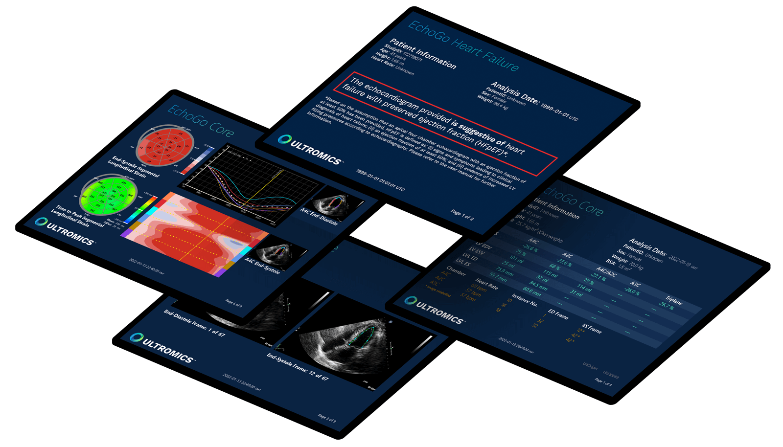 EchoGo for Payers - Ultromics EchoGo for Payers - Ultromics